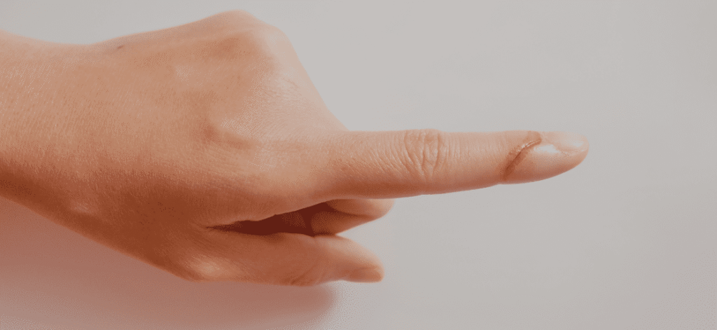 How to Properly Treat Skin Cuts: A Step-by-Step Guide – soframycin.com